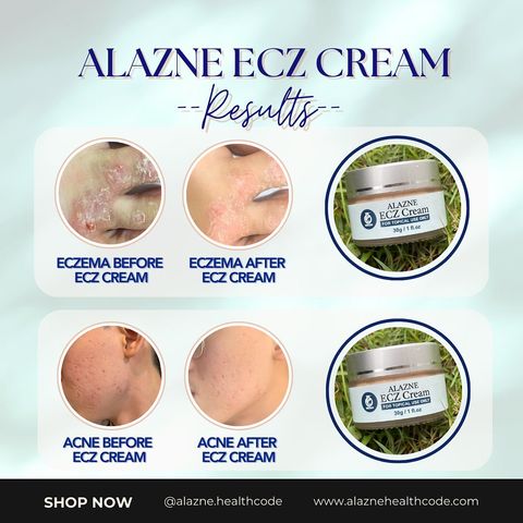 ECZ Cream – Alazne Health Code