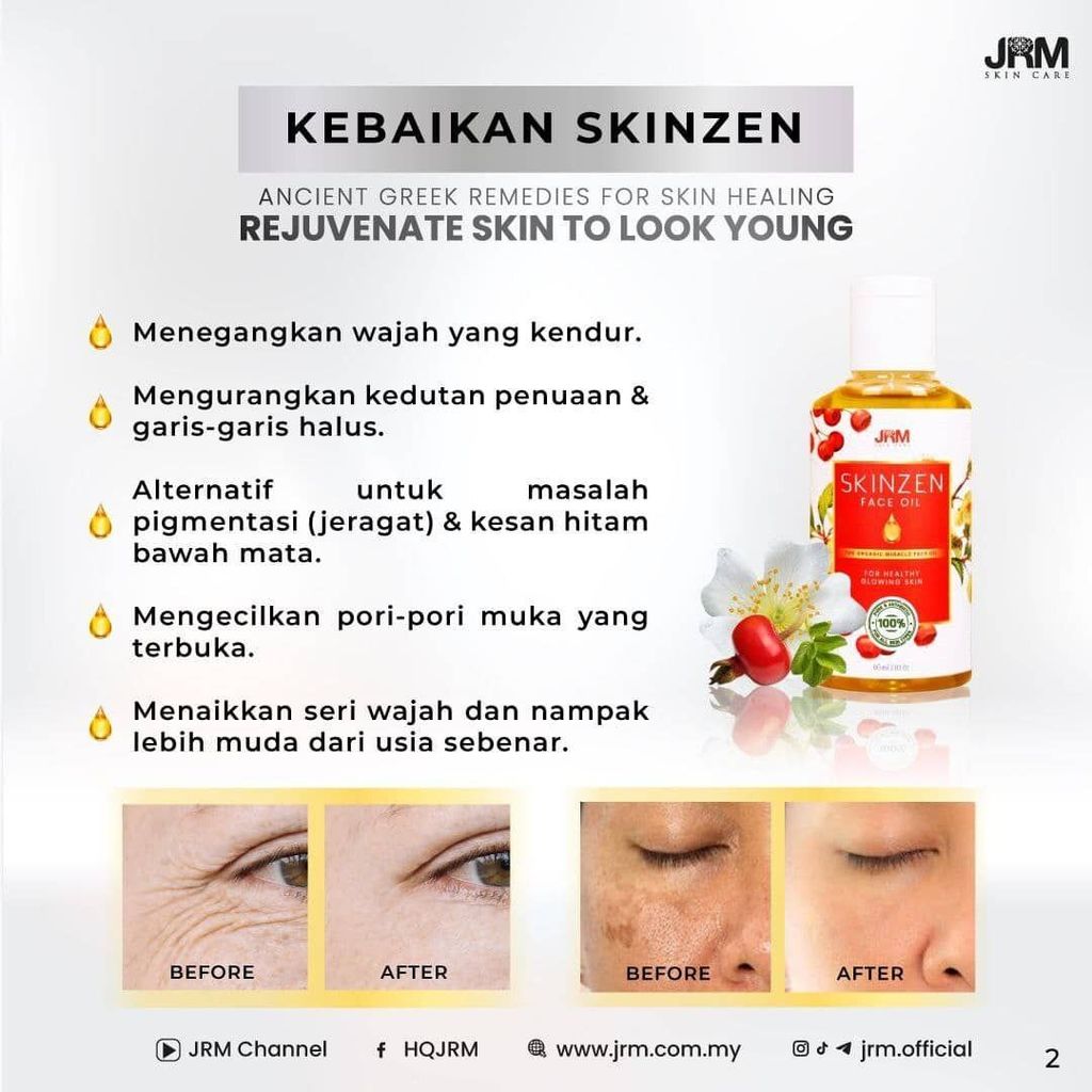 JRM - PROMOSI SKINZEN 60ML – Izamo Sitiawan / Manjung Olive House