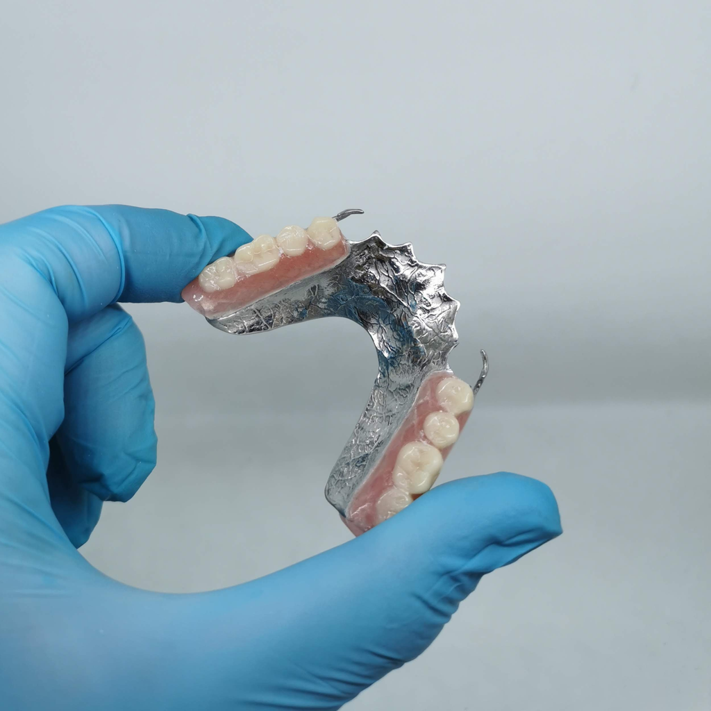 Chrome Cobalt Denture Nexus Denture Lab Services