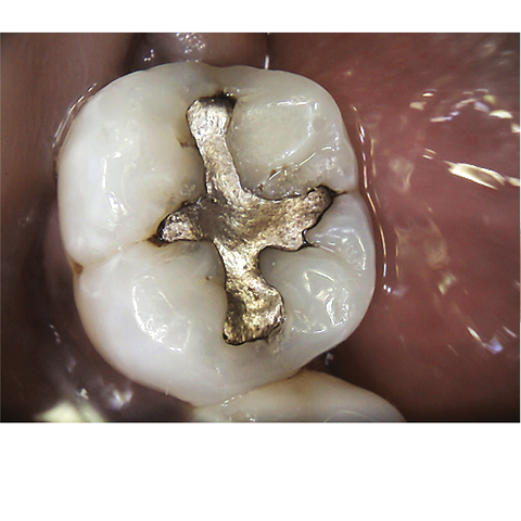 Carestream Intraoral Camera CS 1500 – NTC Mall by NTC Dental Suppliers ...