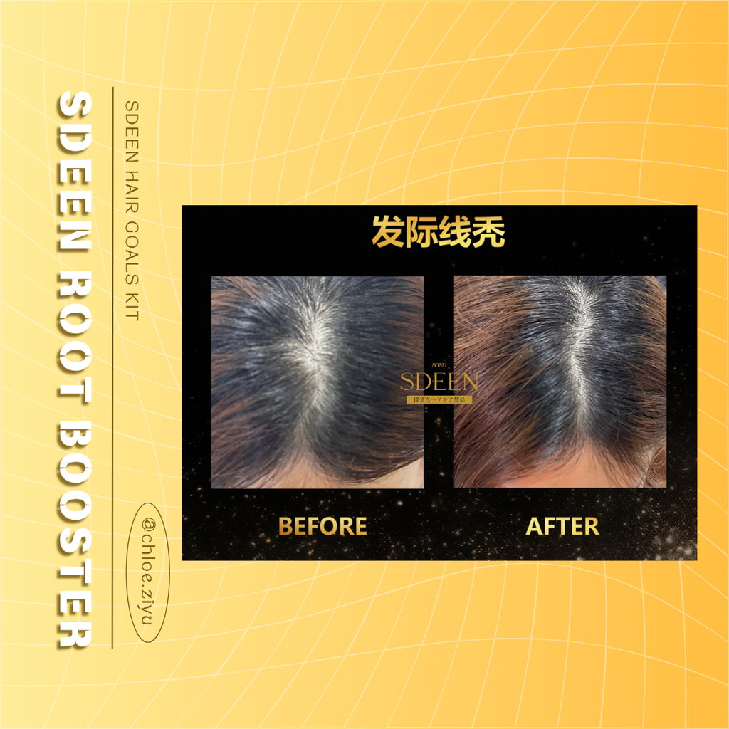 SDEEN HAIR ROOT BOOSTER ｜滴管式生发精华，强韧密发，从“头”开始！🌱💧 – Chloe Law.beauty