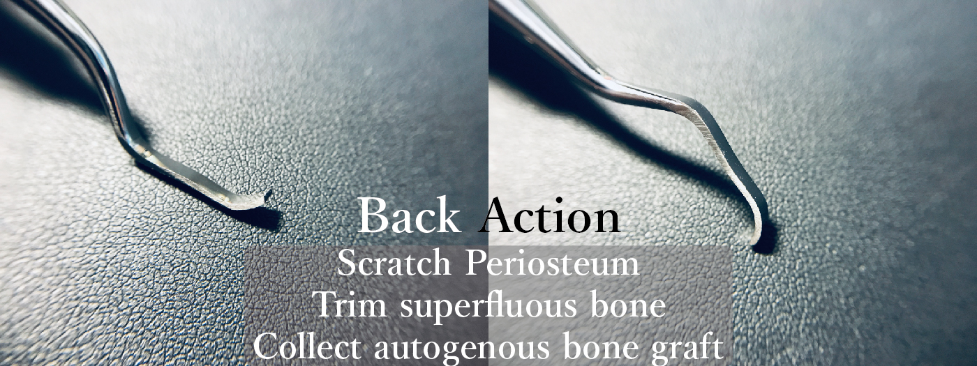 BackAction – SENKA Dental Supply