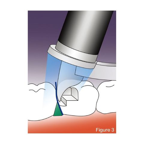 PerForm – SENKA Dental Supply