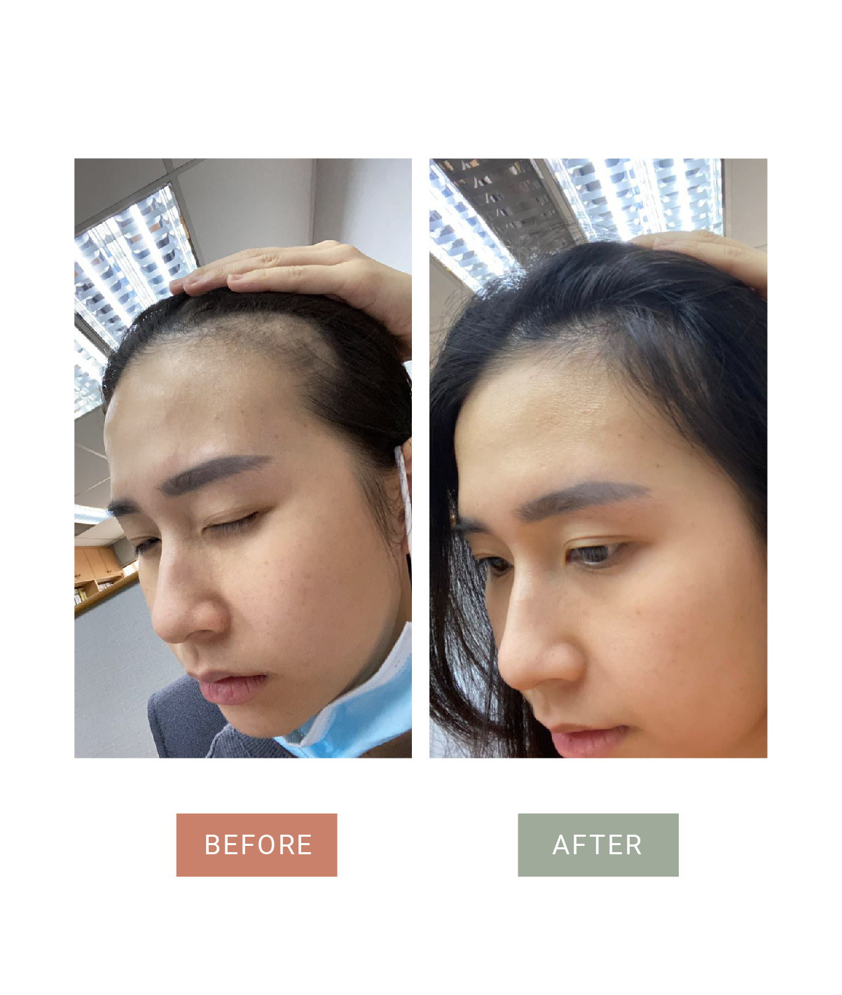 Daskin Before and After – Da Skin