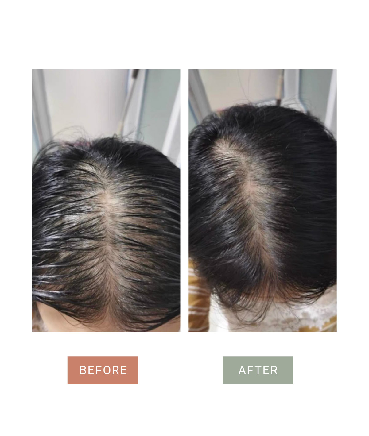 Daskin Before and After – Da Skin