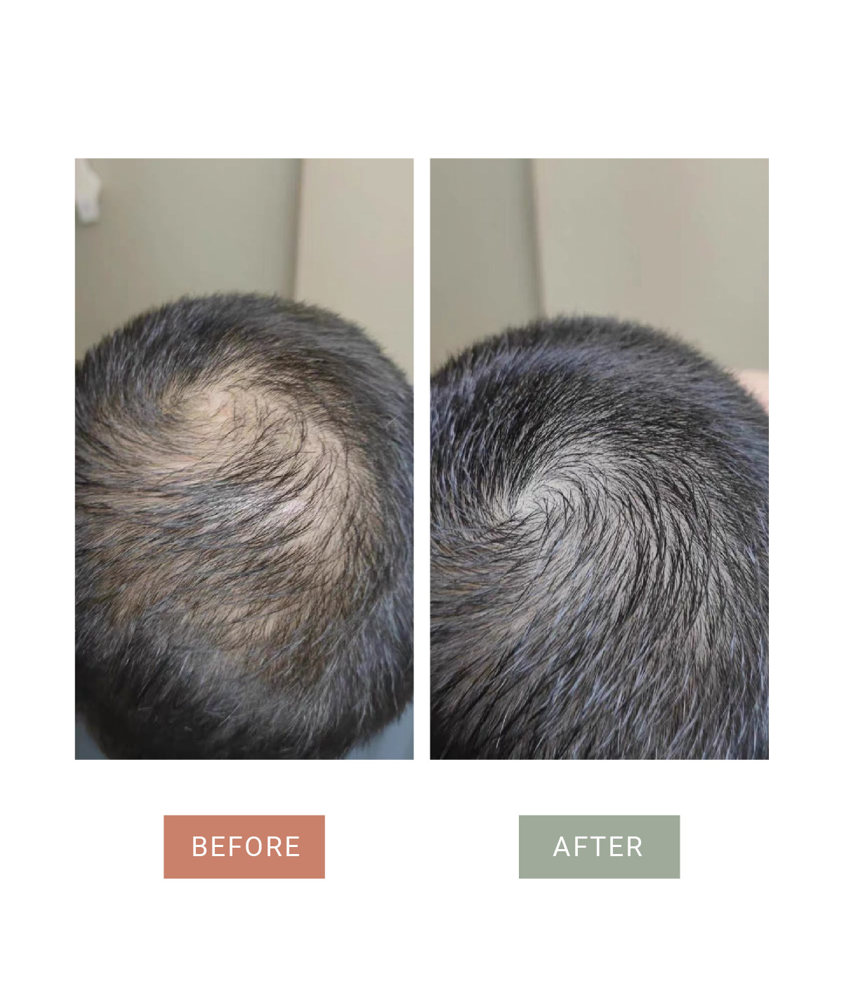 Daskin Before and After – Da Skin