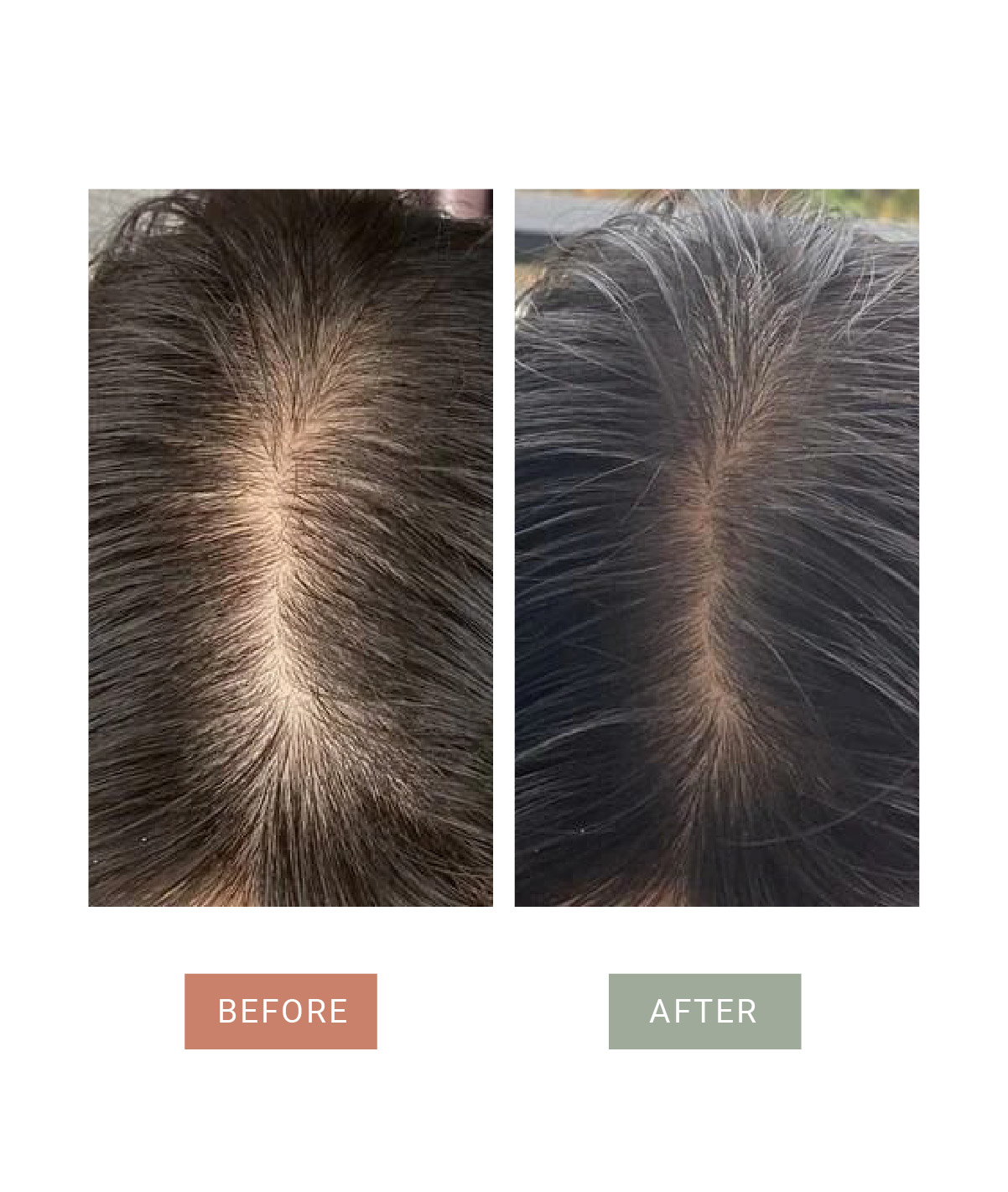 Daskin Before and After – Da Skin