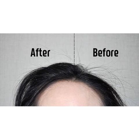 【拥有高颅顶女神头】Forest Story Super Hard Water Spray 定型喷雾 252ml – JuzBeauty ...