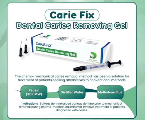Ready Stock DENGEN CARIE-FIX (DENTAL CARIES REMOVING GEL ) (1G)🟢 – MSLI ...